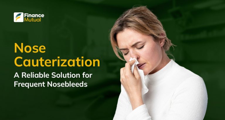 Nose Cauterization: A Reliable Solution for Frequent Nosebleeds